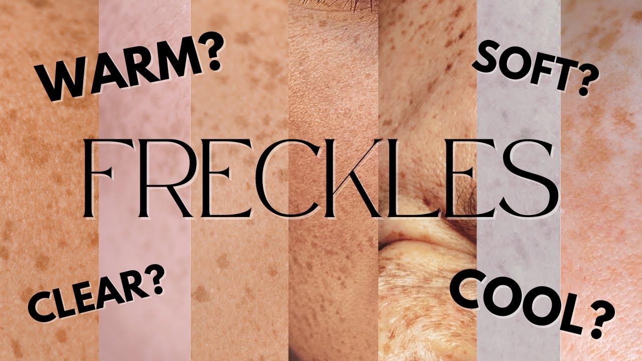 Freckles & Color Analysis: Do They Help or Confuse Your Seasonal ...