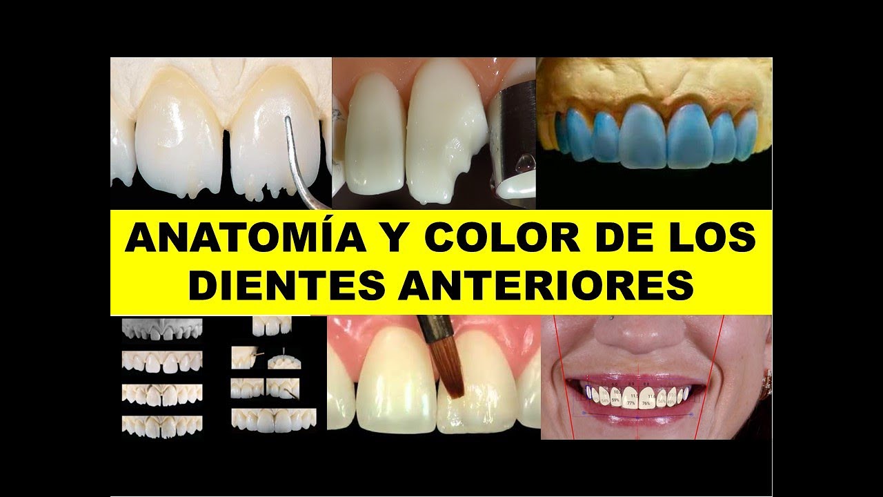 "ANATOMÍA Y COLOR DE LOS DIENTES ANTERIORES" - YouTube