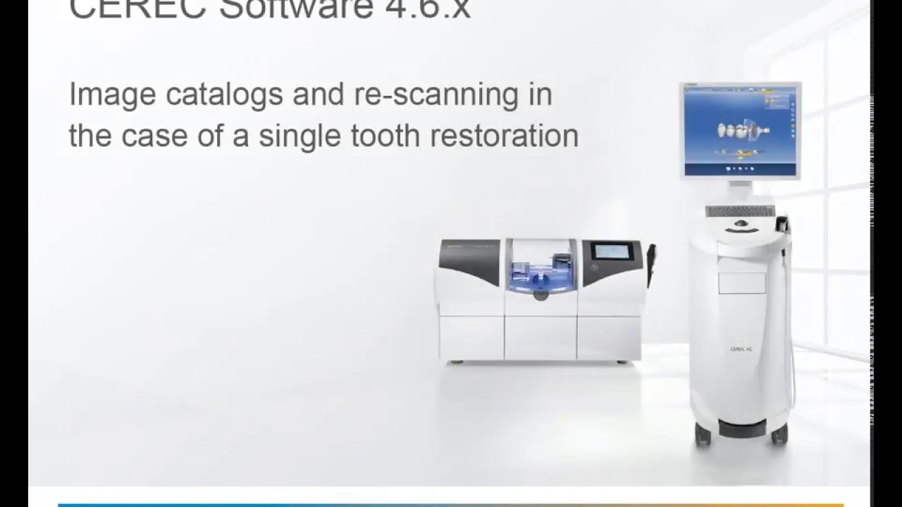 CEREC 4.6.x: Image catalogs and re-scanning in case of a single tooth ...