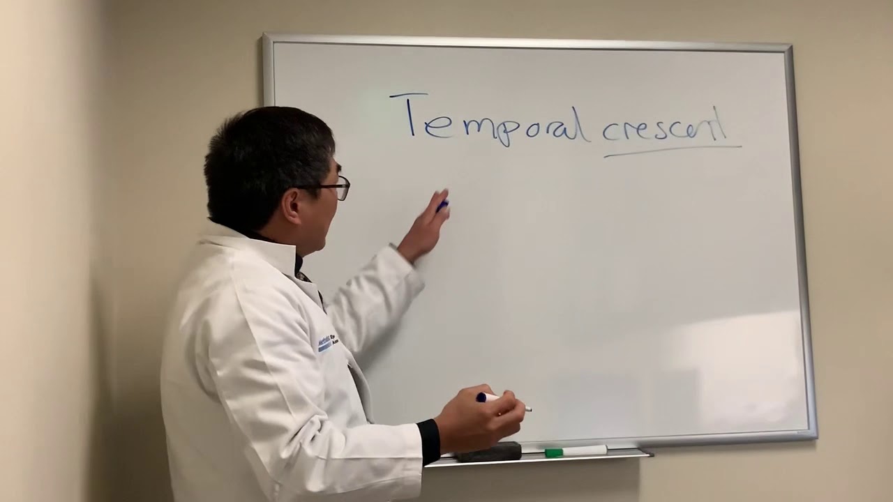 Temporal crescent - YouTube