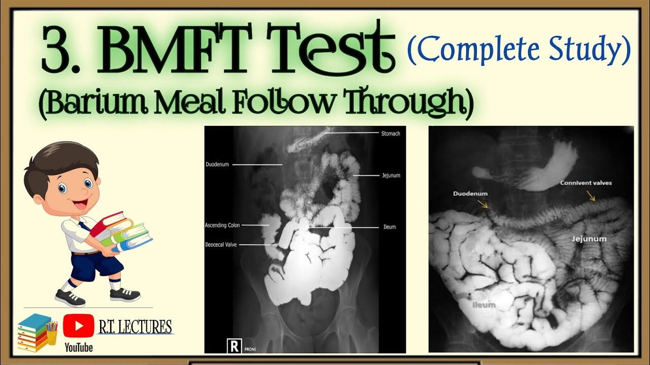 #BMFT complete procedure #Barium Meal Follow Through examination - YouTube