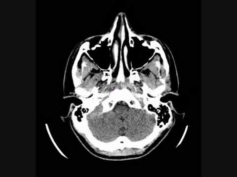 Scanner cérébral - YouTube