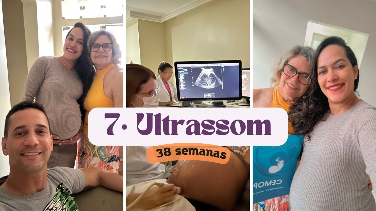Ultrassom Obstétrica Doppler com 38 semanas - YouTube