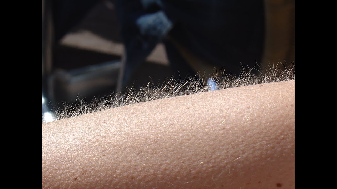 The Quirky Science of Goosebumps! WHY DO WE GET THEM? - YouTube