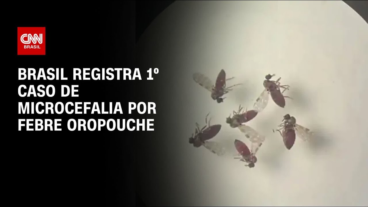 Brasil registra 1º caso de microcefalia por febre oropouche | LIVE CNN ...