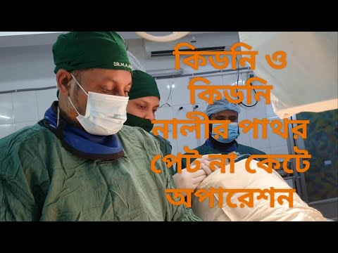 Supine mini PCNL for left upper ureteric & renal stone - YouTube