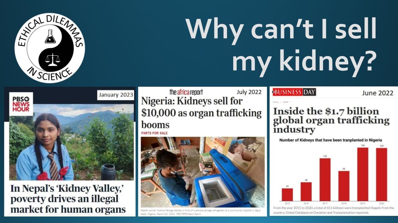 Why can't I sell my kidney? - YouTube