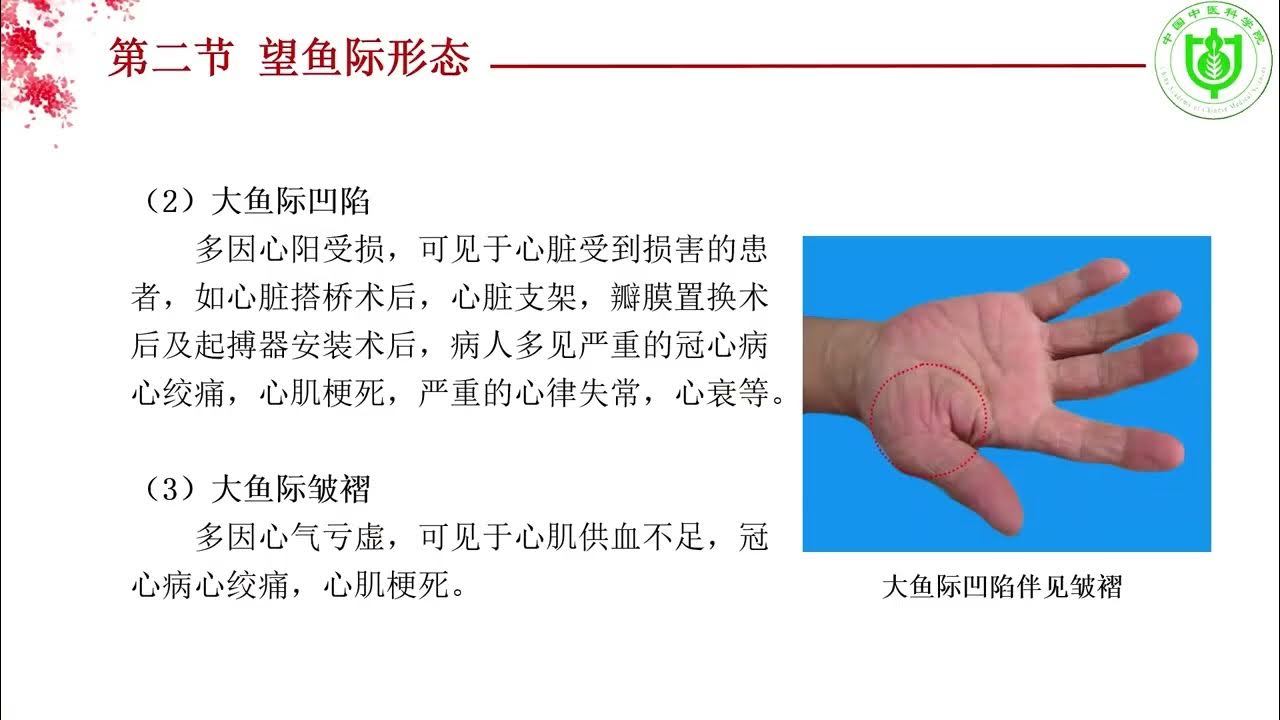 韩学傑老师手診013(12) - YouTube