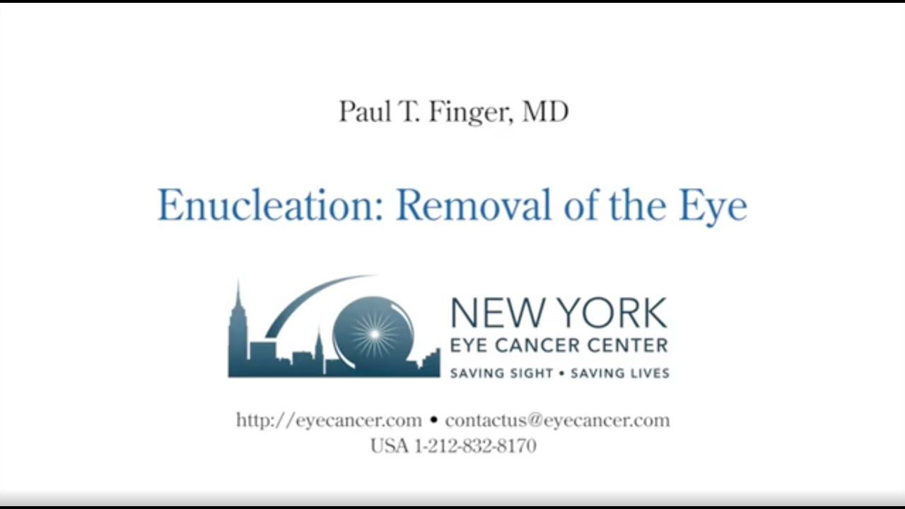 Enucleation (Removal of the Eye) Surgery: Patient Instructions at The ...