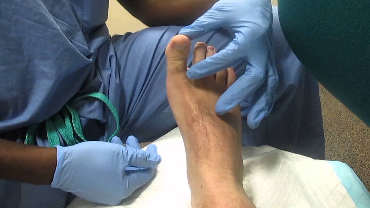 Hallux Block: MWMC Podiatry - YouTube