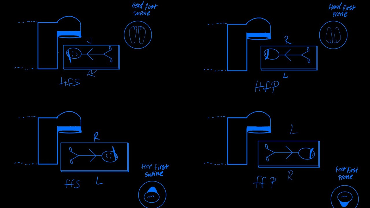 Radiation Therapy Patient Position/Orientations: HFS, HFP, FFP, & FFS - YouTube