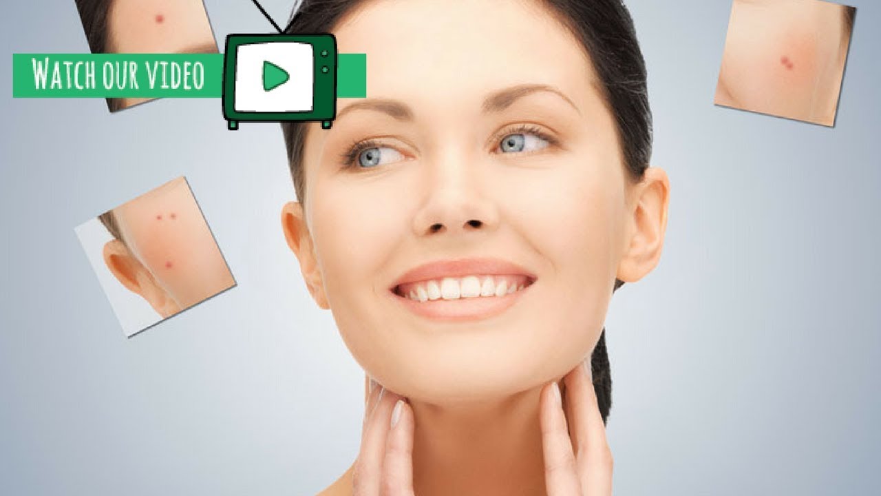 After Seeing This You Will Learn How to Remove Pimples Forever - YouTube