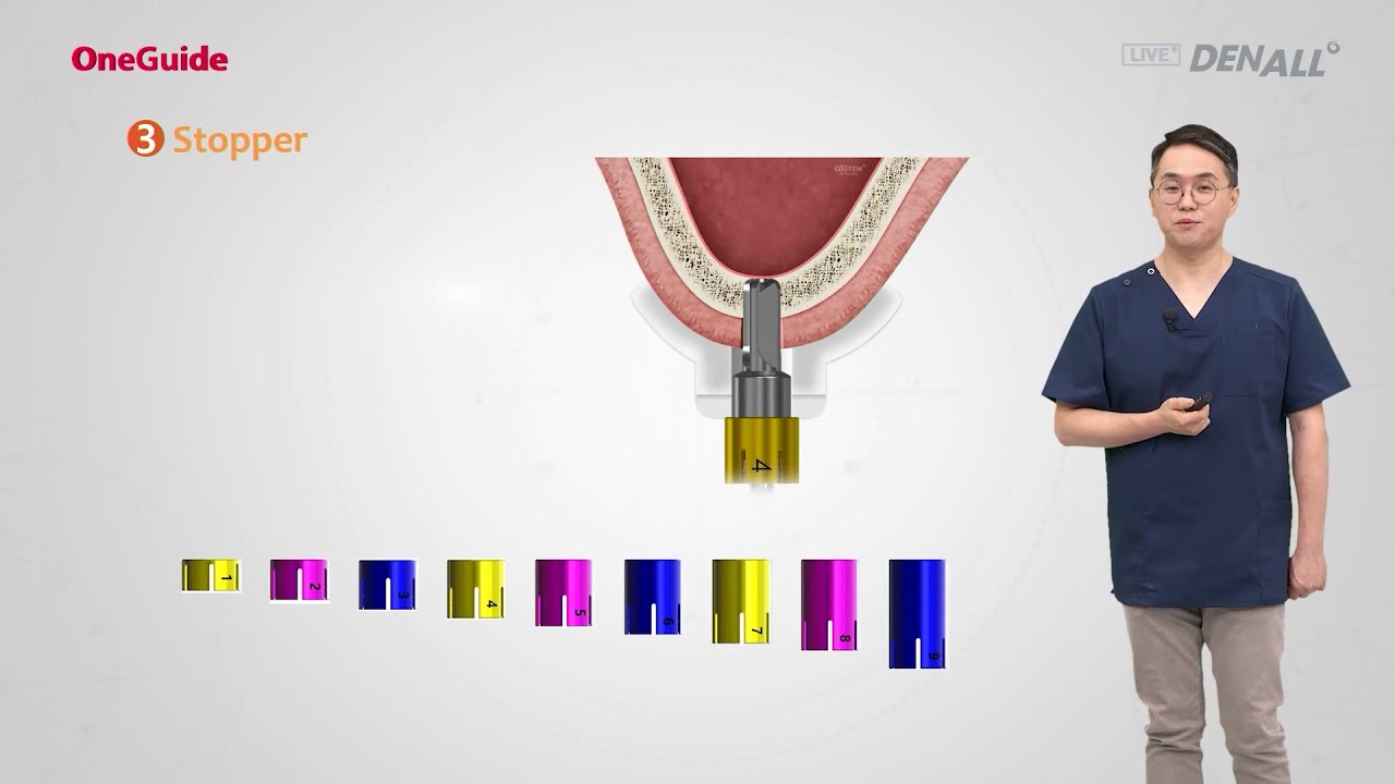 OneGuide - Ep 4. OneCAS System Understanding and Clinical Application ...