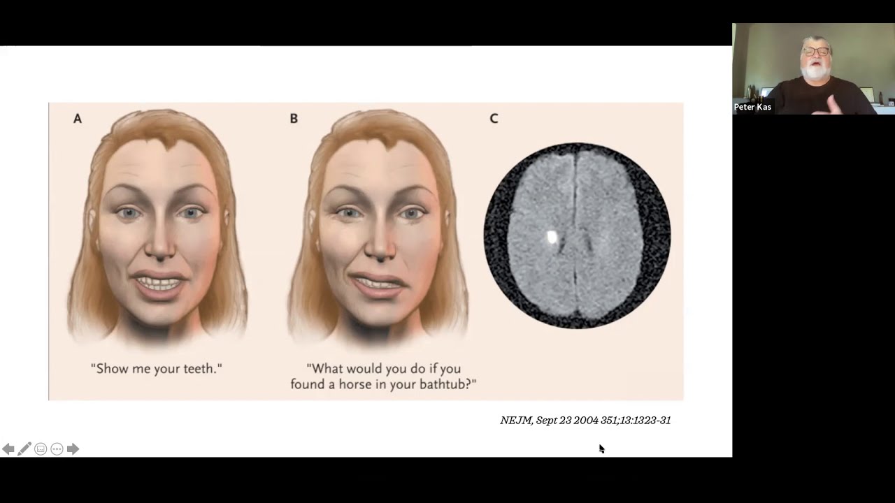 The Rapid Screening Neuro Exam - YouTube