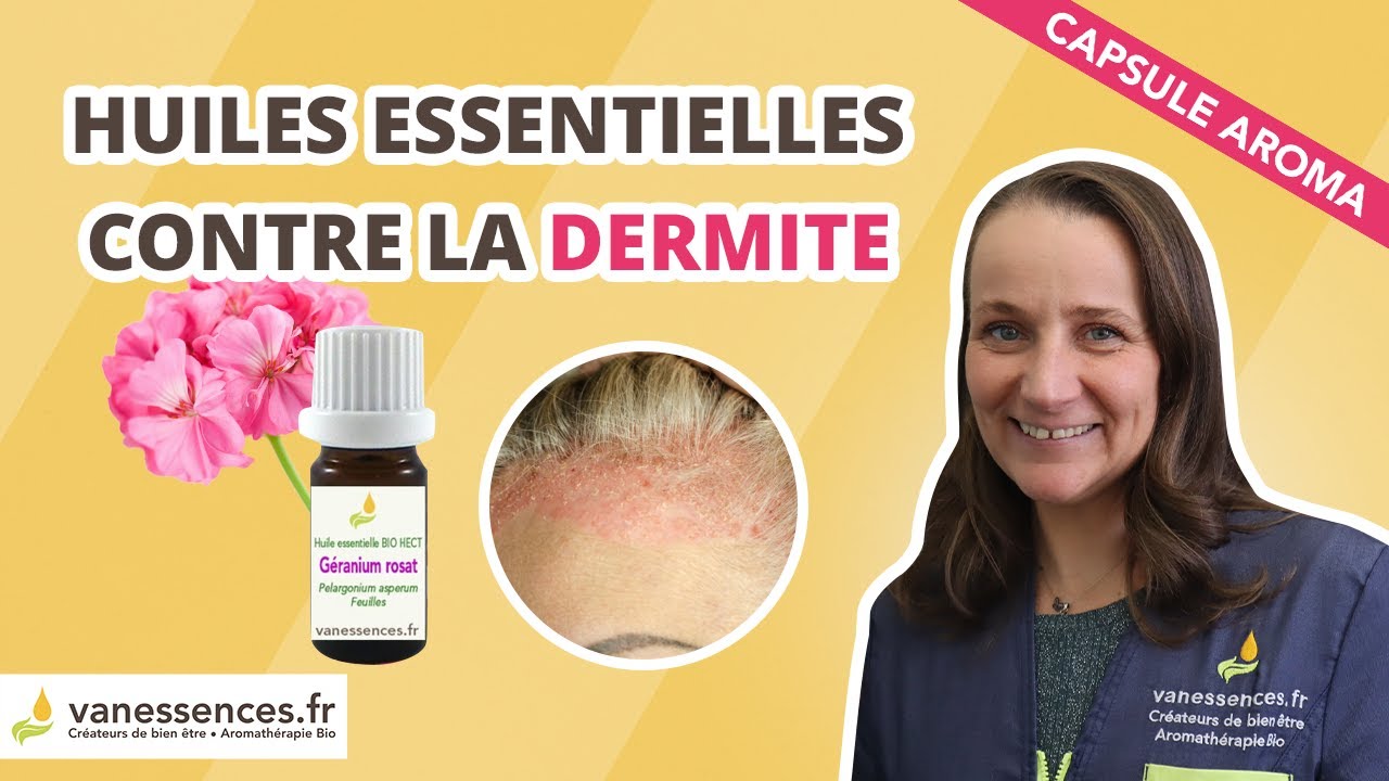 Huile essentielle Dermite séborrhéique : solution naturelle efficace ...