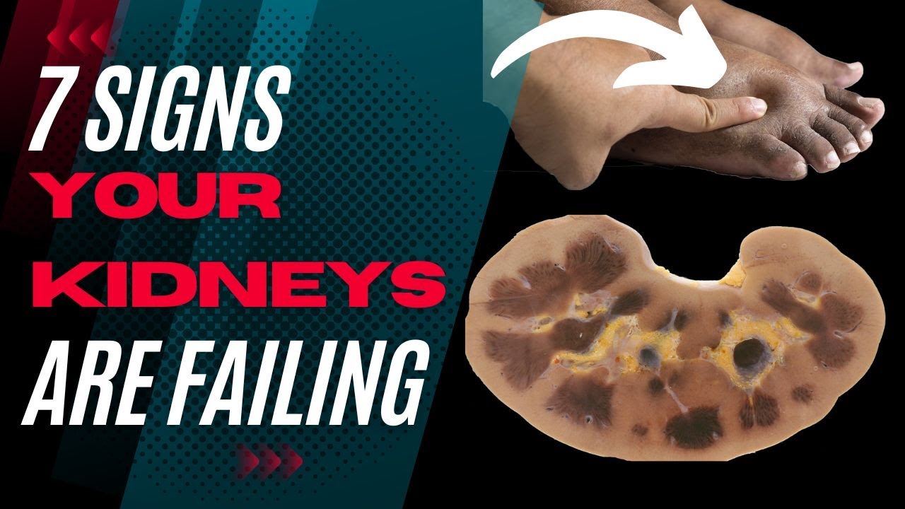7 Warning Signs Your Kidneys Are TOXIC and Failing - Signs of kidney ...