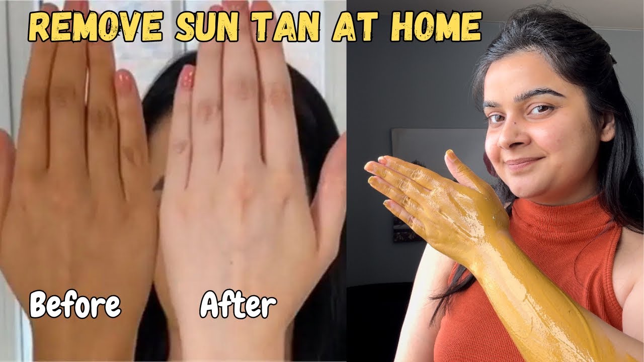 How to remove sun tan quickly at home || Remove Sun Tan From Hands ...