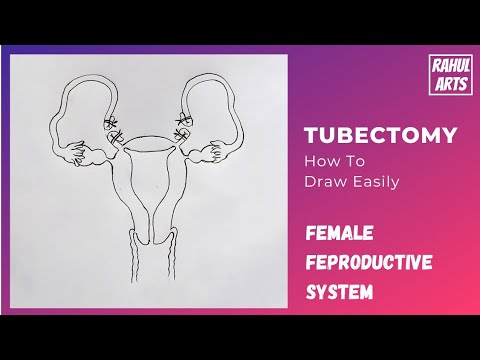 How to draw Tubectomy ; Female reproductive system in easy steps ...