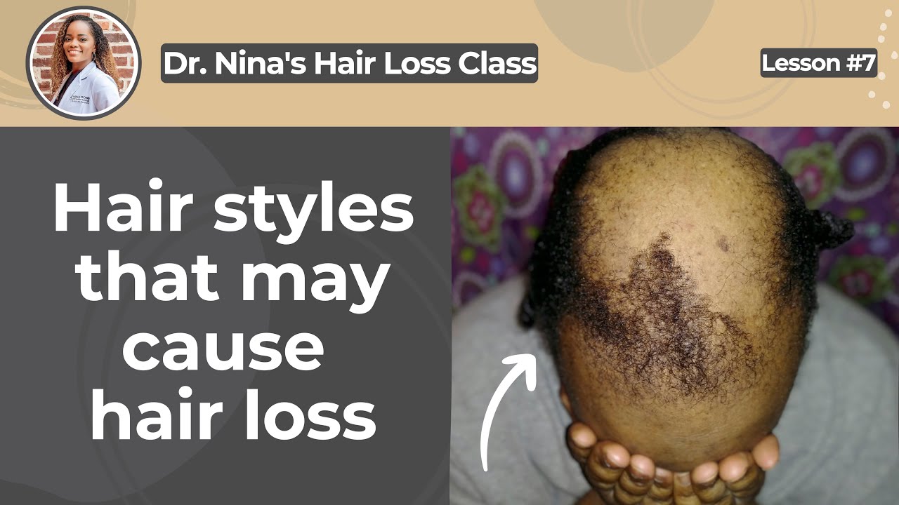 Dr. Nina's Hair Loss Class | Lesson 07 - Styles that may cause hair ...