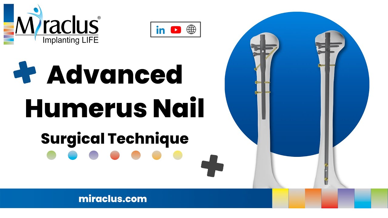 Advanced Humerus Nail | Indications, Features & Surgical Technique ...