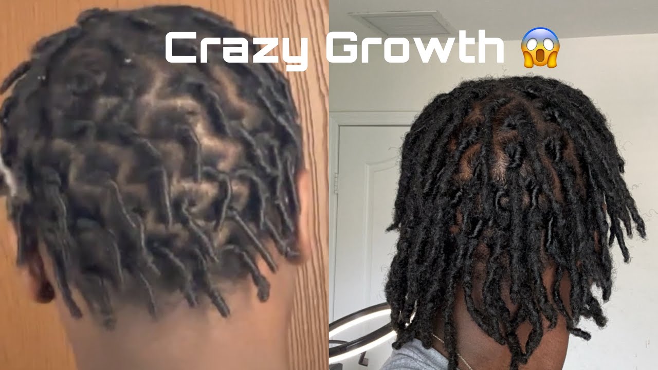 MY 1 YEAR LOC JOURNEY!*Trust In The Process* - YouTube