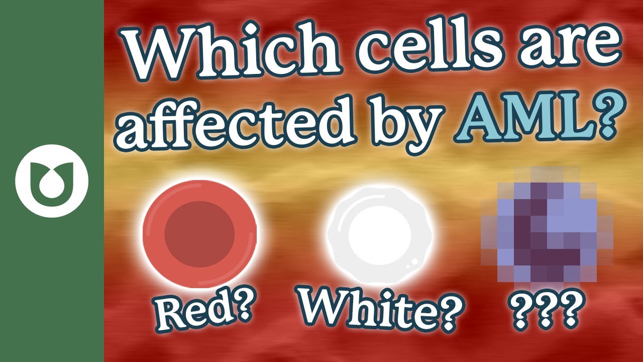 What type of cells are affected in AML? #AML - YouTube