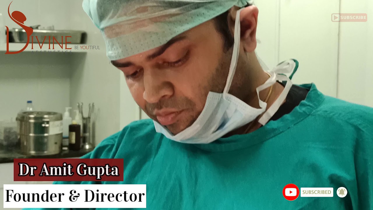 Grade 2 Gynecomastia Surgery with Dr Amit Gupta Plastic Surgeon - YouTube