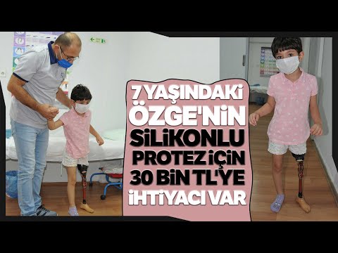 Bacağı Kesilen Özge’ye Silikonlu Protez İçin 30 Bin TL Gerekiyor