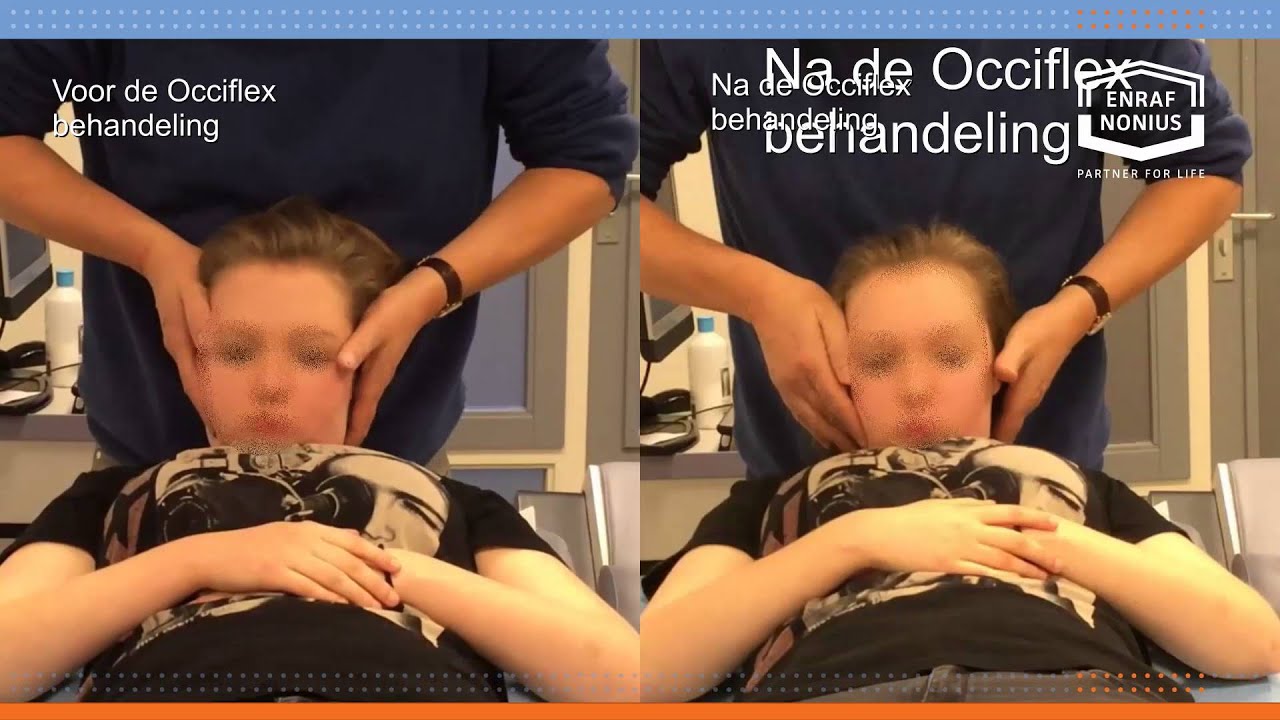Occiflex - before and after treatment ROM results - YouTube