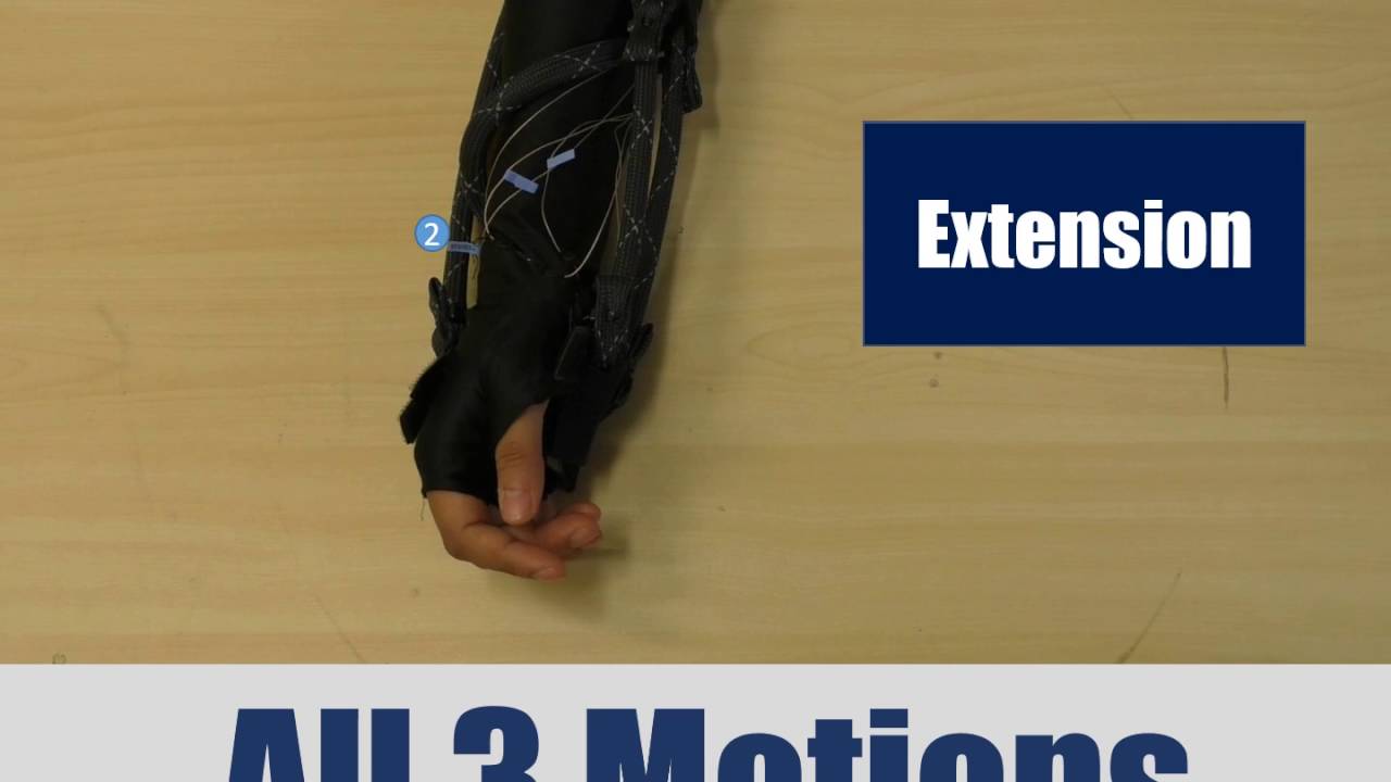 Wrist Assistive Glove Co-Developed by Cassie Lowell, S.B. '17 - YouTube