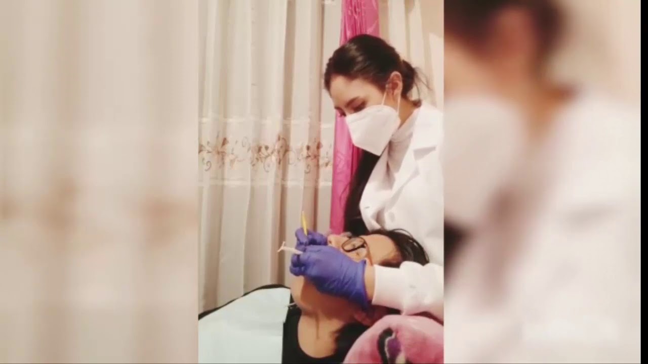 Llenado del odontograma con los indices CPO - YouTube