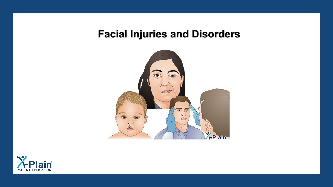 Facial Injuries and Disorders - YouTube