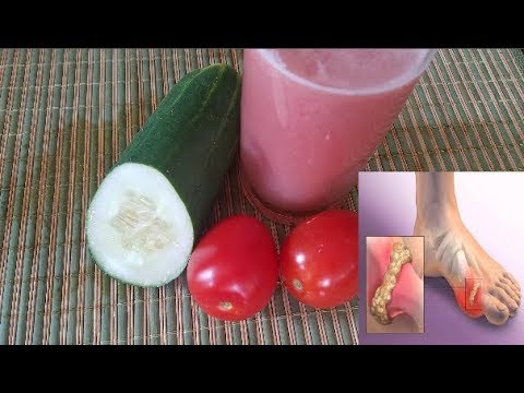 ACIDE URIQUE EN EXCÈS: traitement EFFICACE pour REDUIR le taux D'ACIDE ...