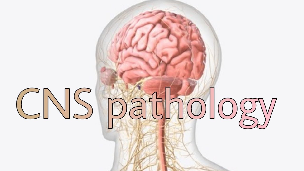 CNS pathology 2nd lecture. - YouTube