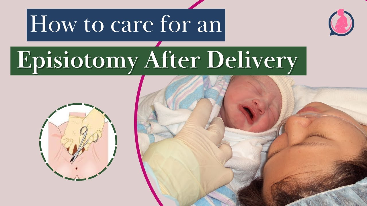How to Care for Episiotomy & Perineal Tears After Birth: Secrets to ...