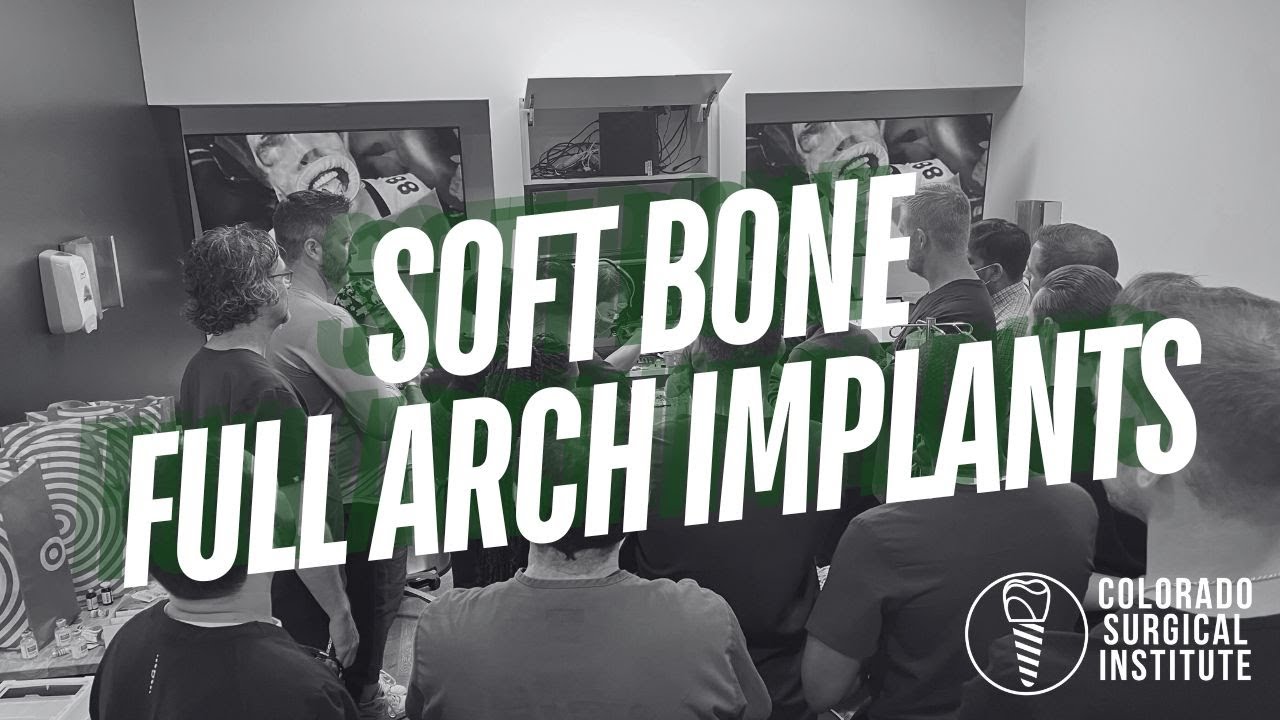 Achieving Optimal Lip Support in Full-Arch Cases: Advanced Extraction ...