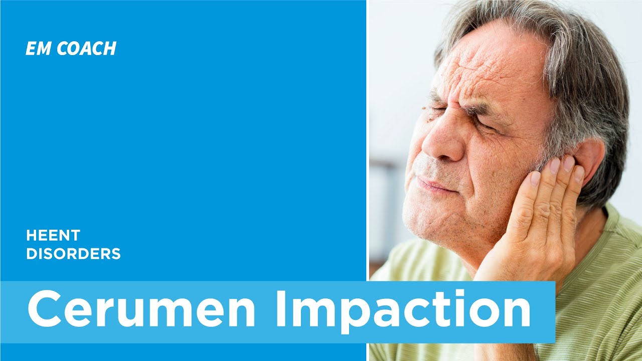 Cerumen Impaction - YouTube