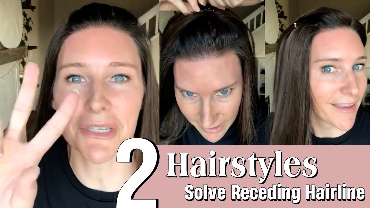 2 Hairstyles to Cover Receding Hairline with Hair Topper - YouTube