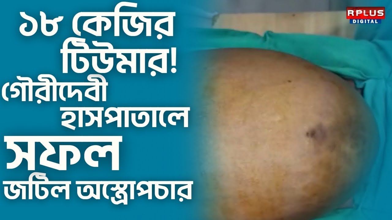 Gouri Devi Hospital News : ১৮ কেজির টিউমার! গৌরীদেবী হাসপাতালে সফল জটিল ...