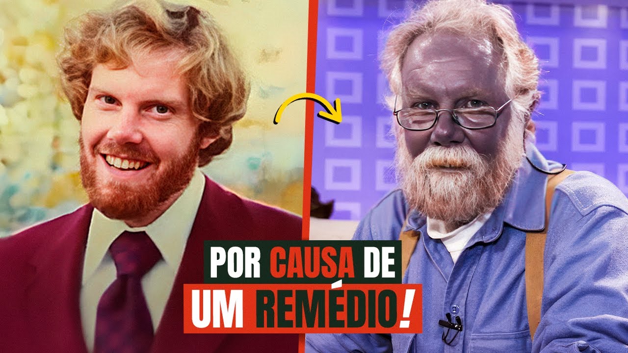 UM REMÉDIO DEIXOU A PELE DESSE HOMEM AZUL - YouTube