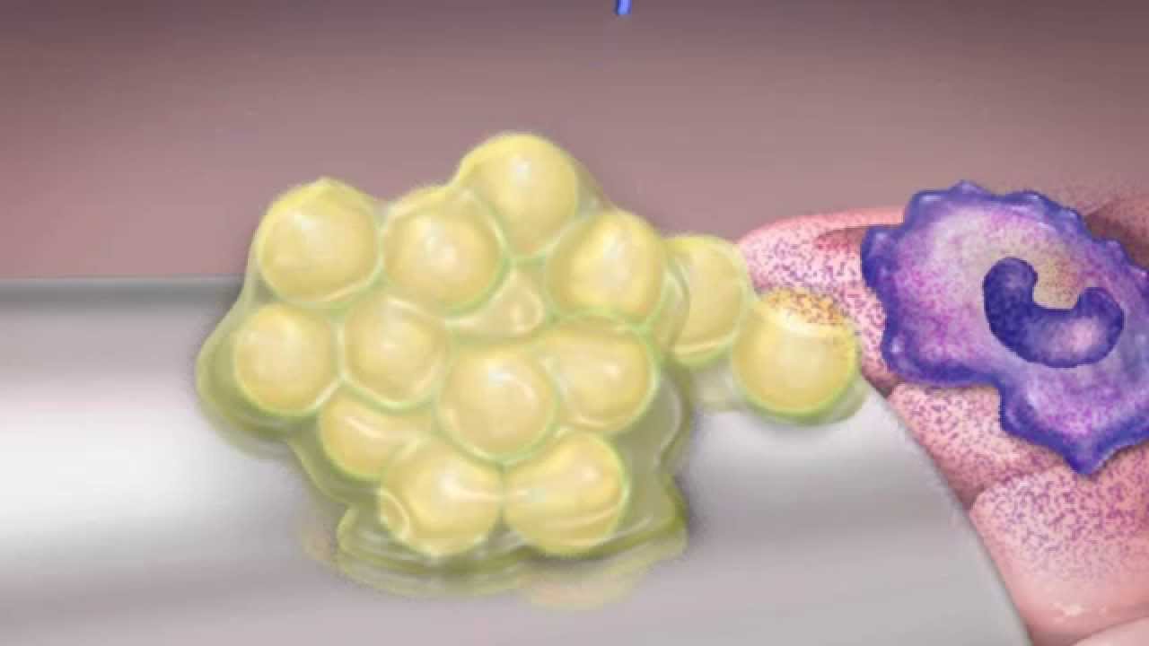 Formation of Biofilm on Implant Surface - YouTube