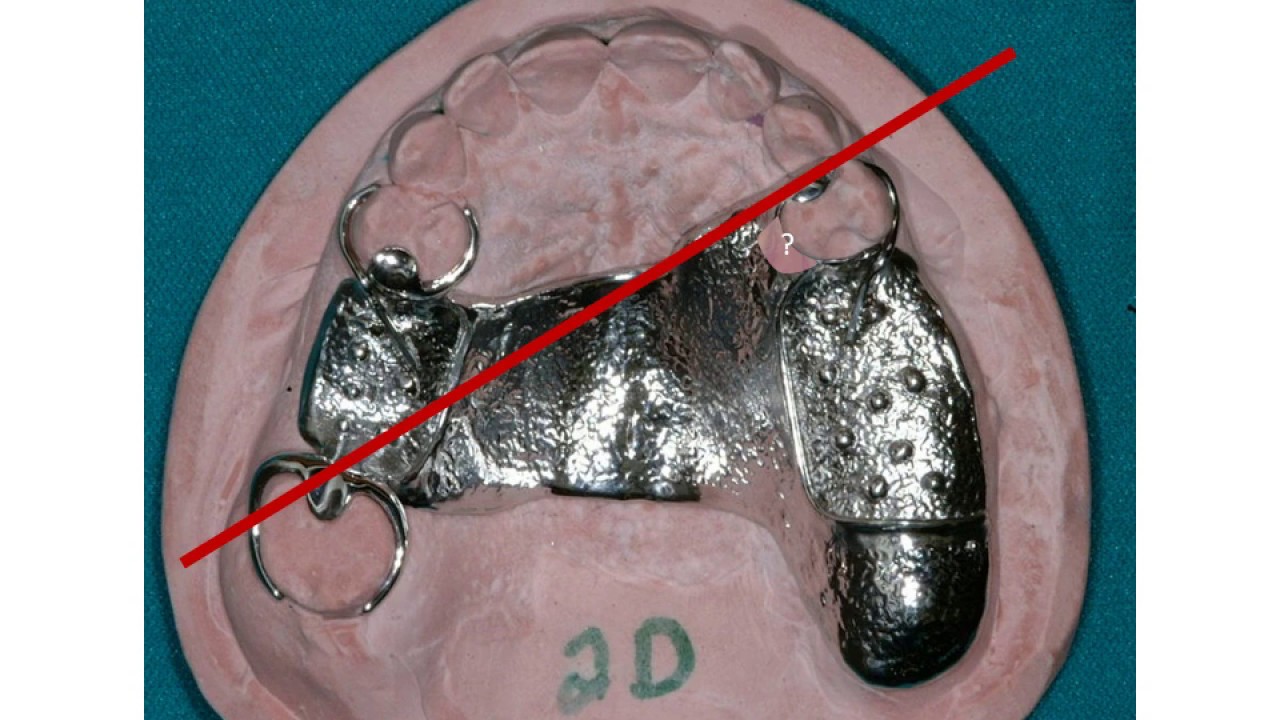 RPD Framework Design Critique - YouTube