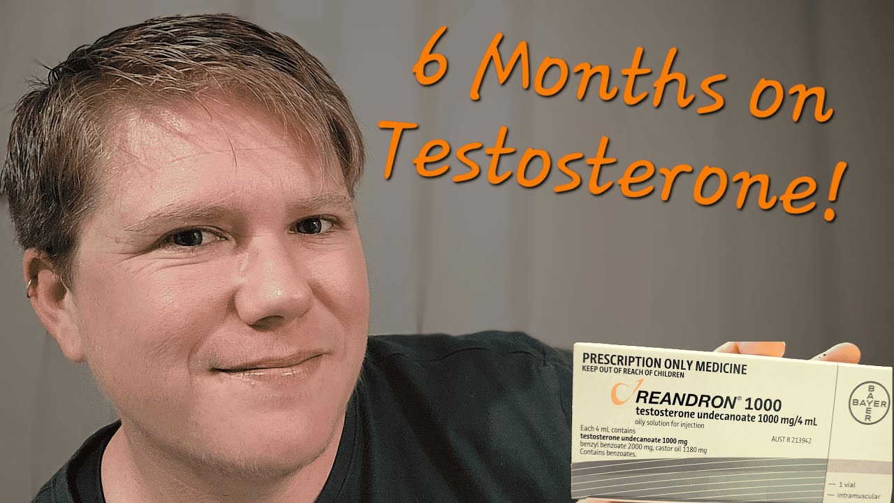 6 Months on Testosterone Progress - 36 Yrs Old and Transitioning FtM ...
