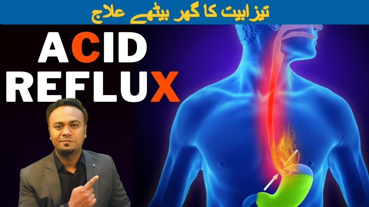 Fix Acid Reflux / Gerd Naturally - تیزابیت کا گھر بیٹھے علاج - एसिडिटी ...