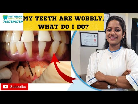 My Teeth are Wobbly ,What do I Do? Mithran Dental | DrJayalakshmi - YouTube