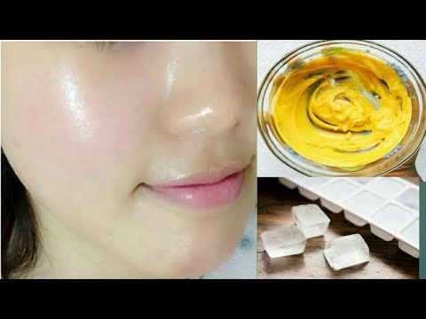 Baby soft skin in week at home/How to get baby soft,smooth skin. # ...