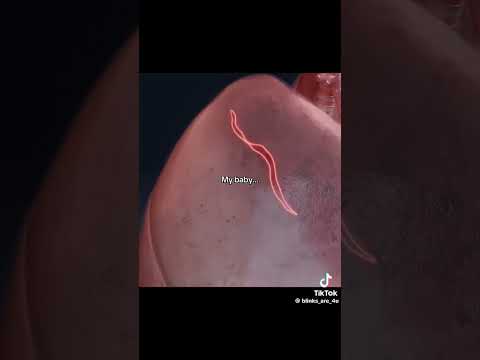 Rami😭,#rami ,#babymonster,#pneumothorax ,#triste