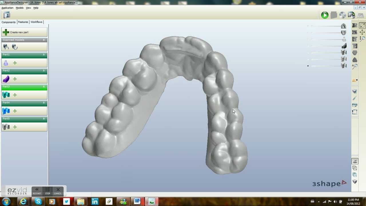 3Shape Ortho: Appliance designer - YouTube