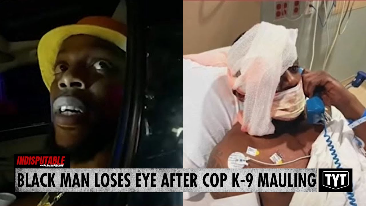 Black Motorist Loses Eye After Police K-9 Mauling - YouTube