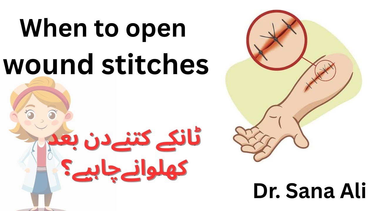 When Should You Remove Stitches After Surgery? | Doctor Explains - YouTube